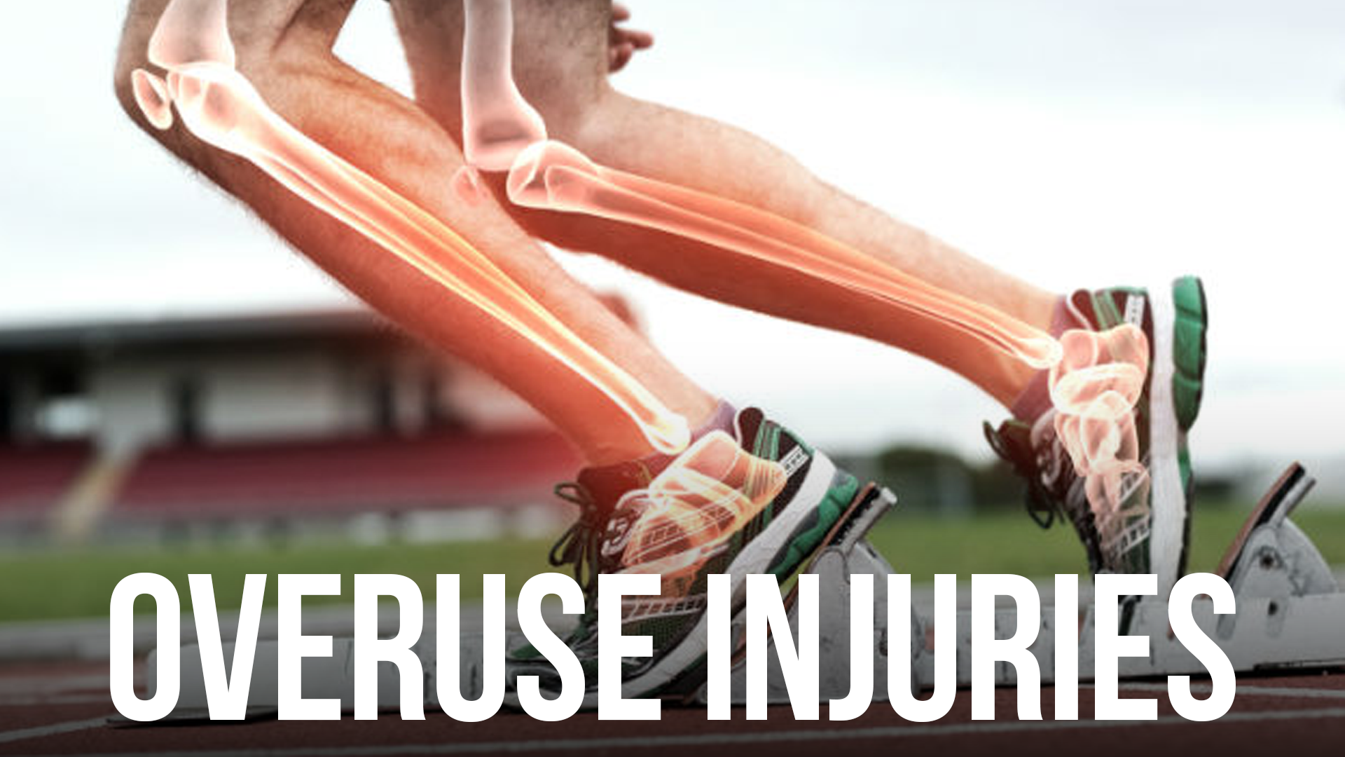 Youth Inc. Recommends: Information and Resources for Overuse Injuries ...